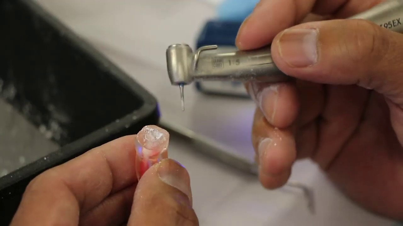 One Hour Molar Root Canal, Build-Up and Crown Course - YouTube