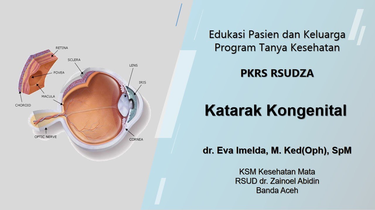 Katarak Kongenital oleh dr. Eva Imelda, M. Ked(Oph), SpM - YouTube