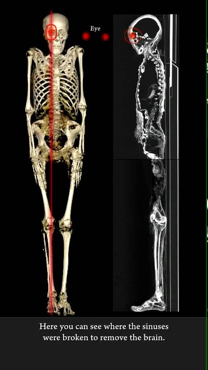 Mummy CT Scan animation - YouTube