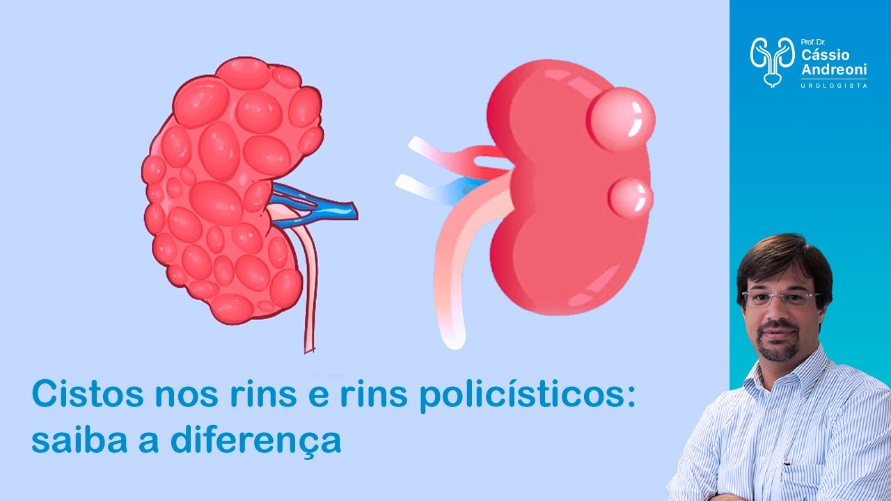 Cisto De Conteúdo Anecogênico No Rim - RETOEDU