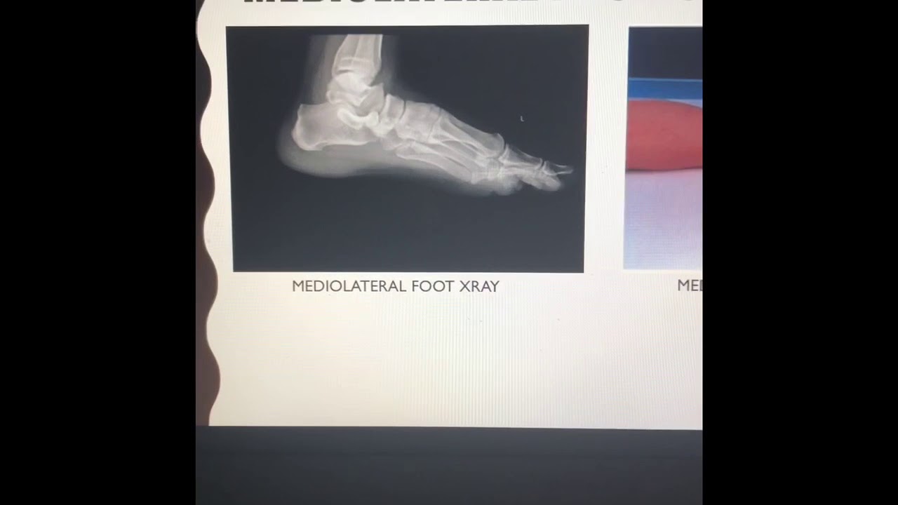 Foot projections and positioning by Gianna - YouTube