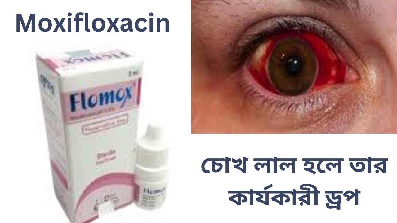 Flomox eye drop ||| Moxifloxacin ||| চোখ লাল হলে তার কার্যকারী ড্রপ ...
