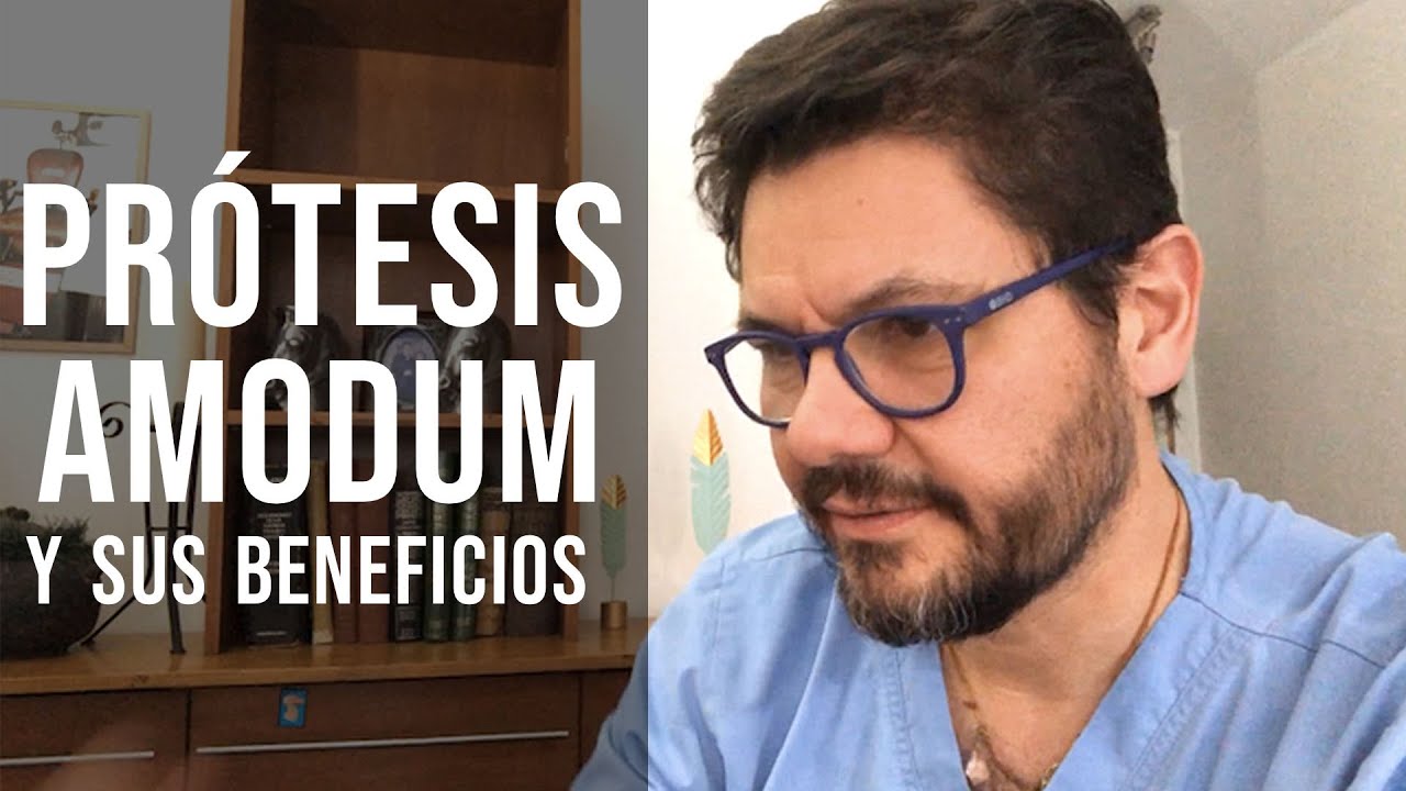 Implantes Dentales para Protesis Admodum: Prótesis fija total sobre ...