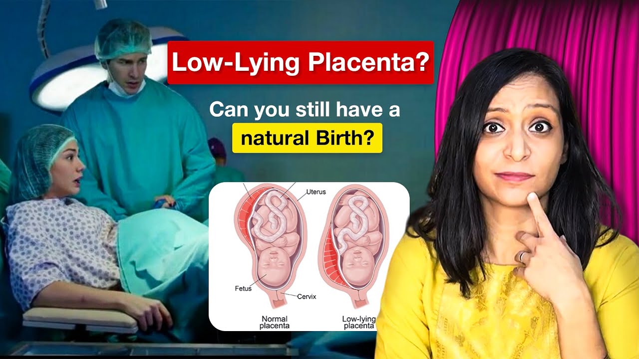 Low Lying Placenta at 13 Weeks: Is Your Baby Safe? Real Causes, Risks ...