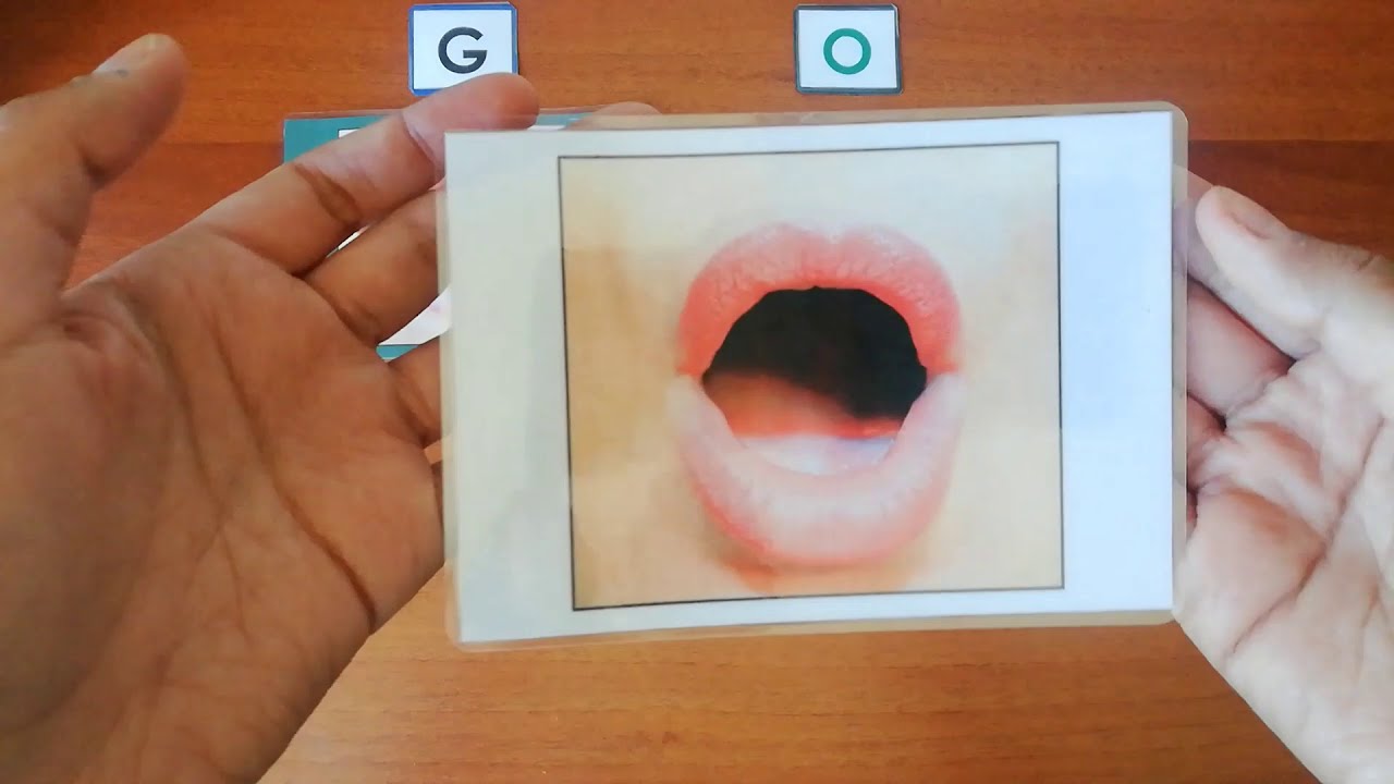 Cada letra su sonido G - Recursos Fonoaudiológicos - YouTube