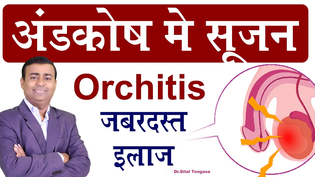 अंडकोष में सुजन orchitis जबरदस्त इलाज I Orchitis causes and treatment ...