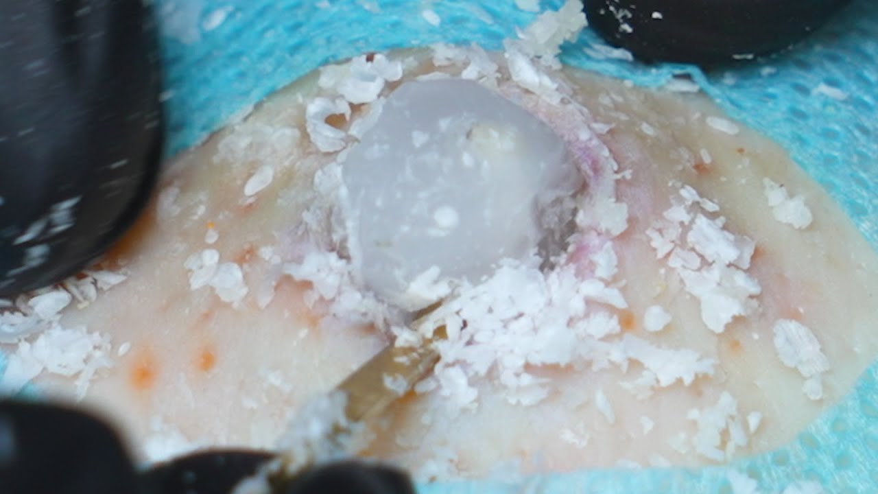 Dr. Lee Geoff Butler Enilsa MrPopZit 🌝 Professional pedicure process ...