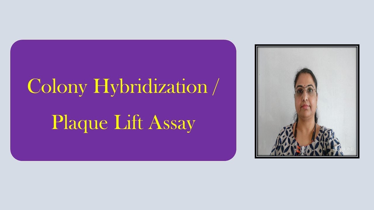 Colony Hybridization and Plaque Lift Assay - YouTube