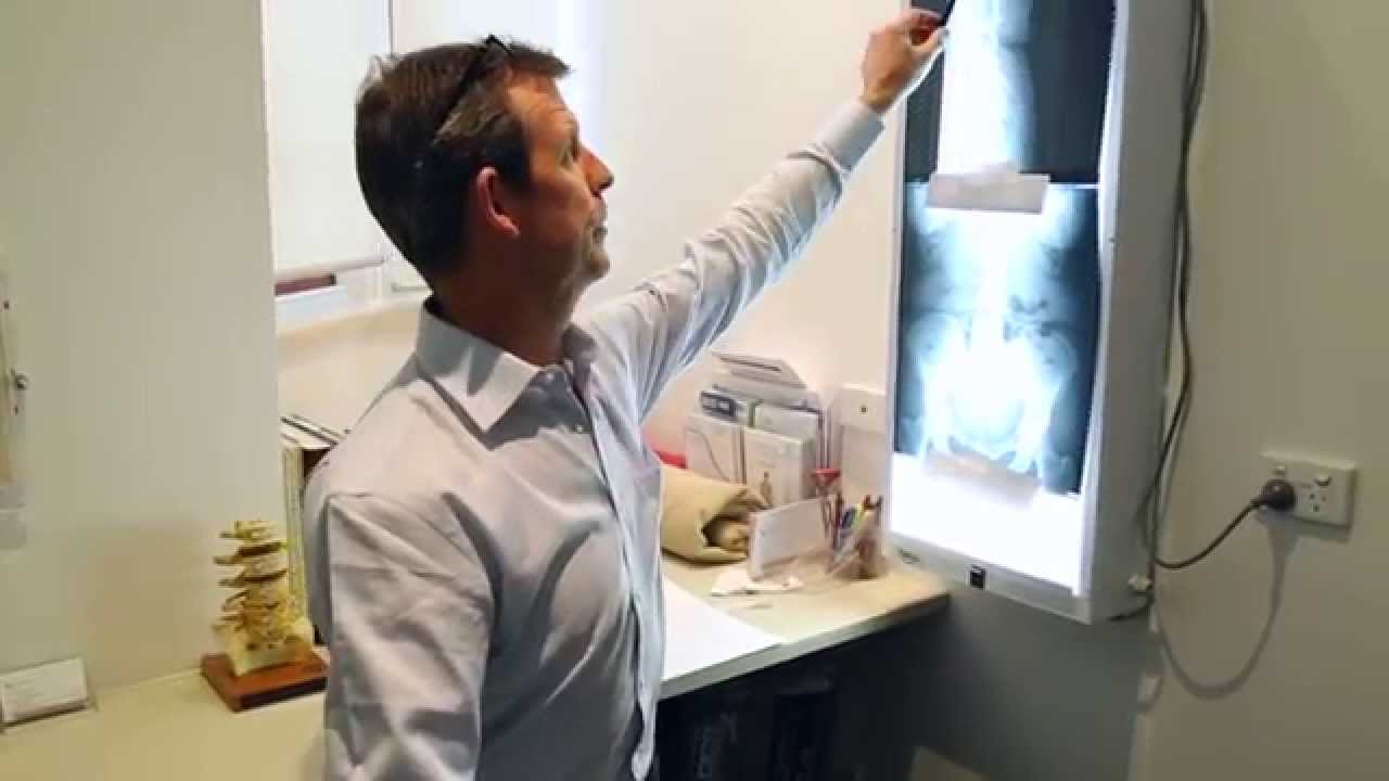 Welcome to Andrew Vincent Chiropractic - YouTube