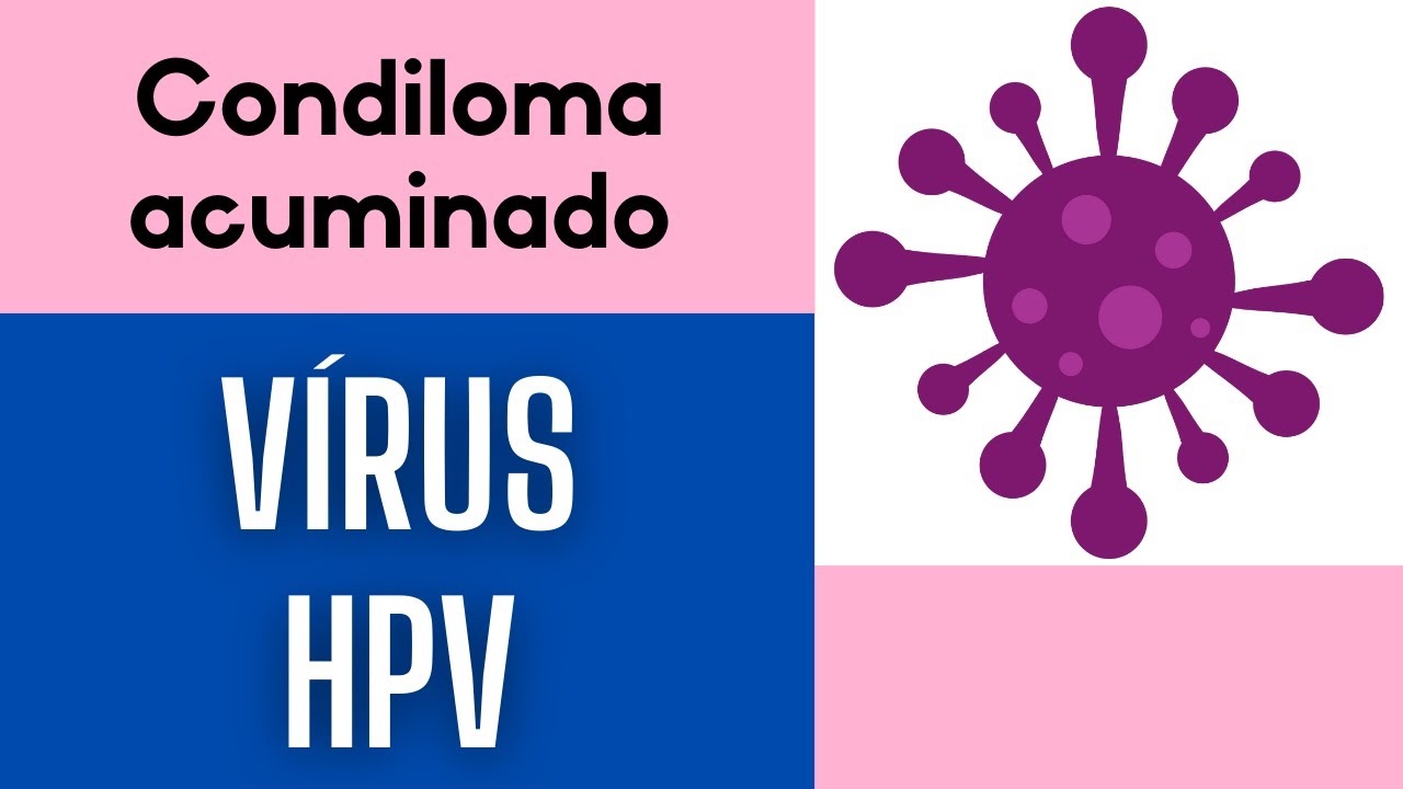 IST - Condiloma acuminado e câncer do colo do útero - vírus HPV - YouTube