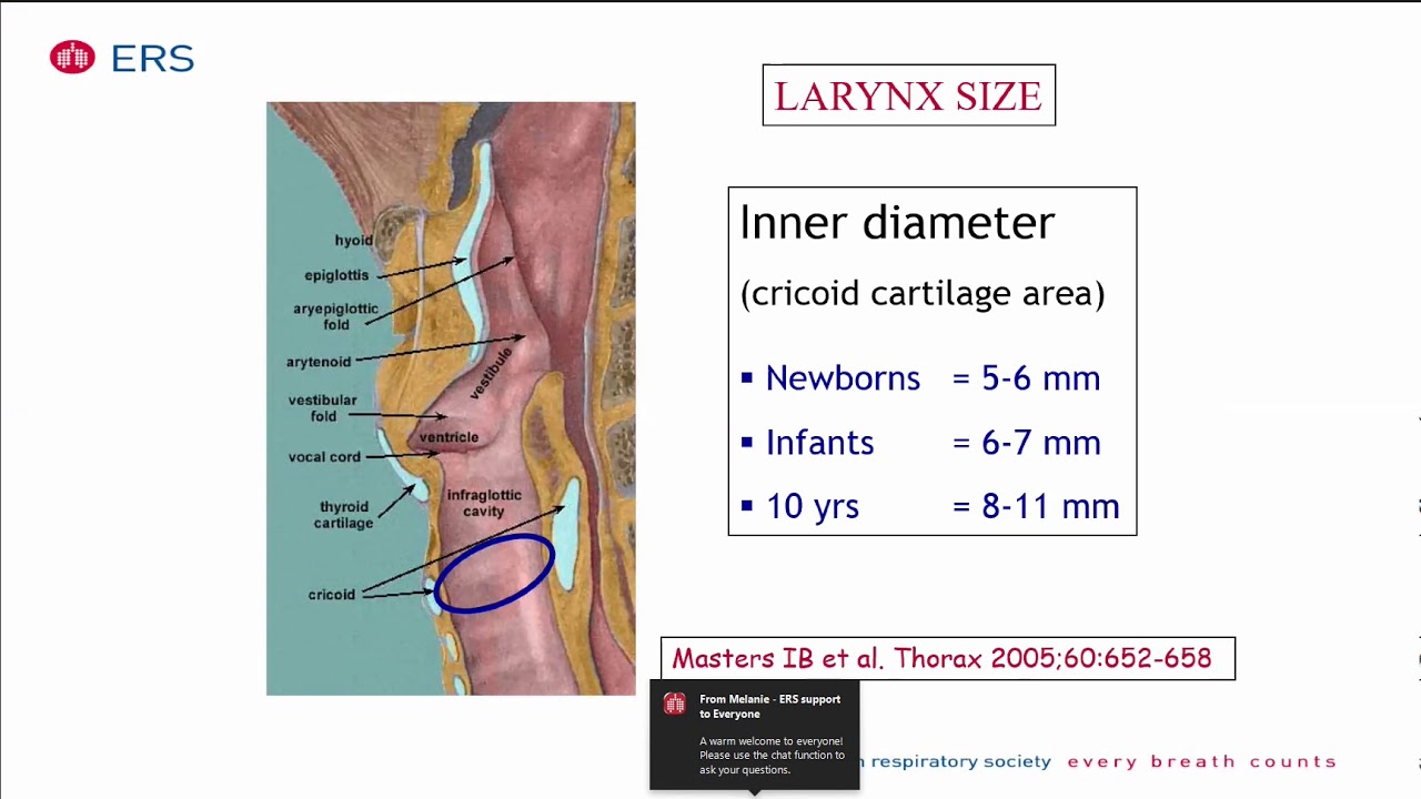 Bronchoscopy in Children by Dr Fabio Midulla - YouTube