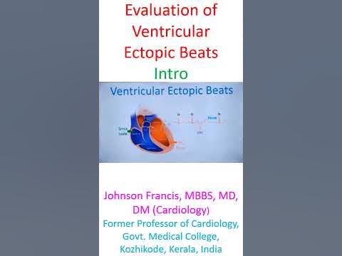 Evaluation of Ventricular Ectopic Beats - YouTube