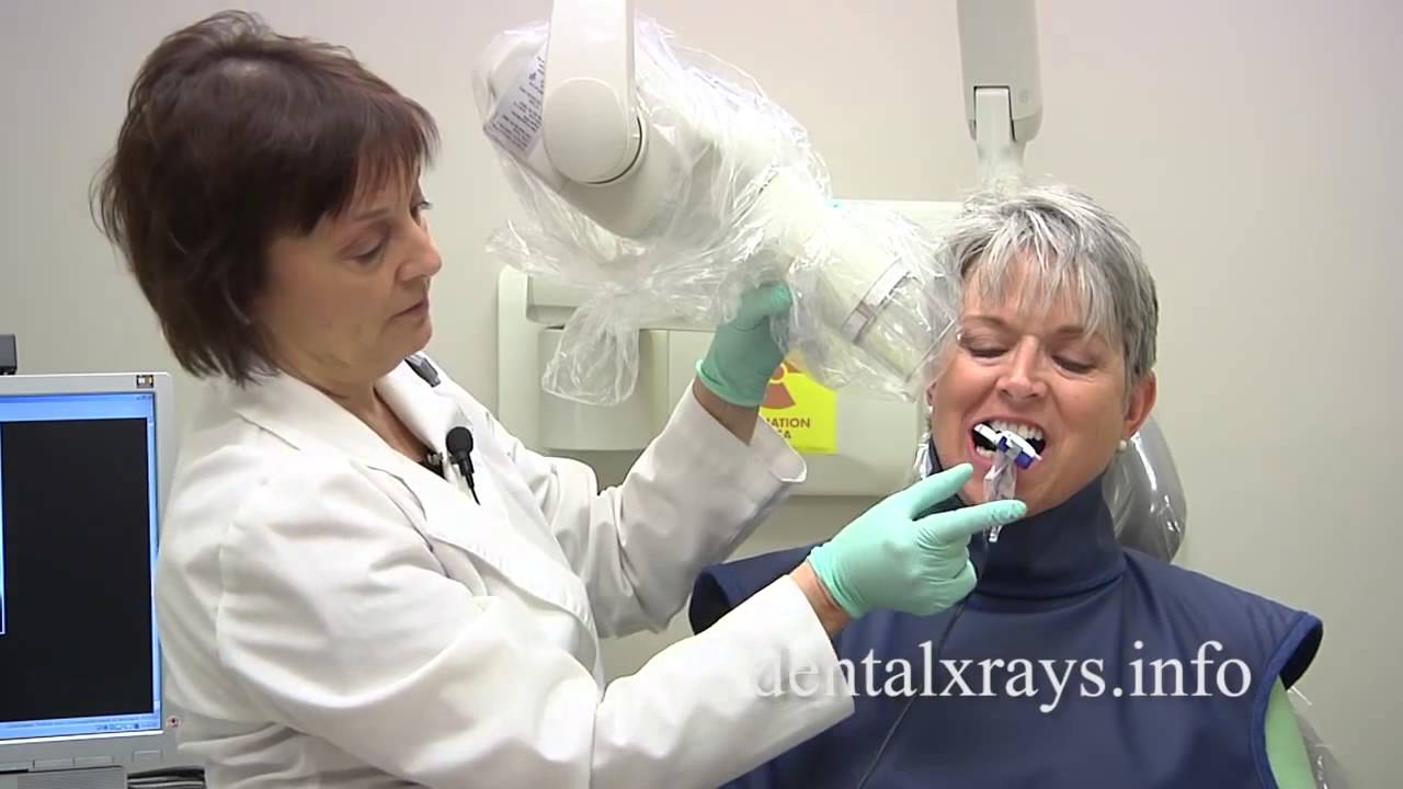 How To Take Dental X-Rays With Bisecting Angle positioning | Dentsply ...