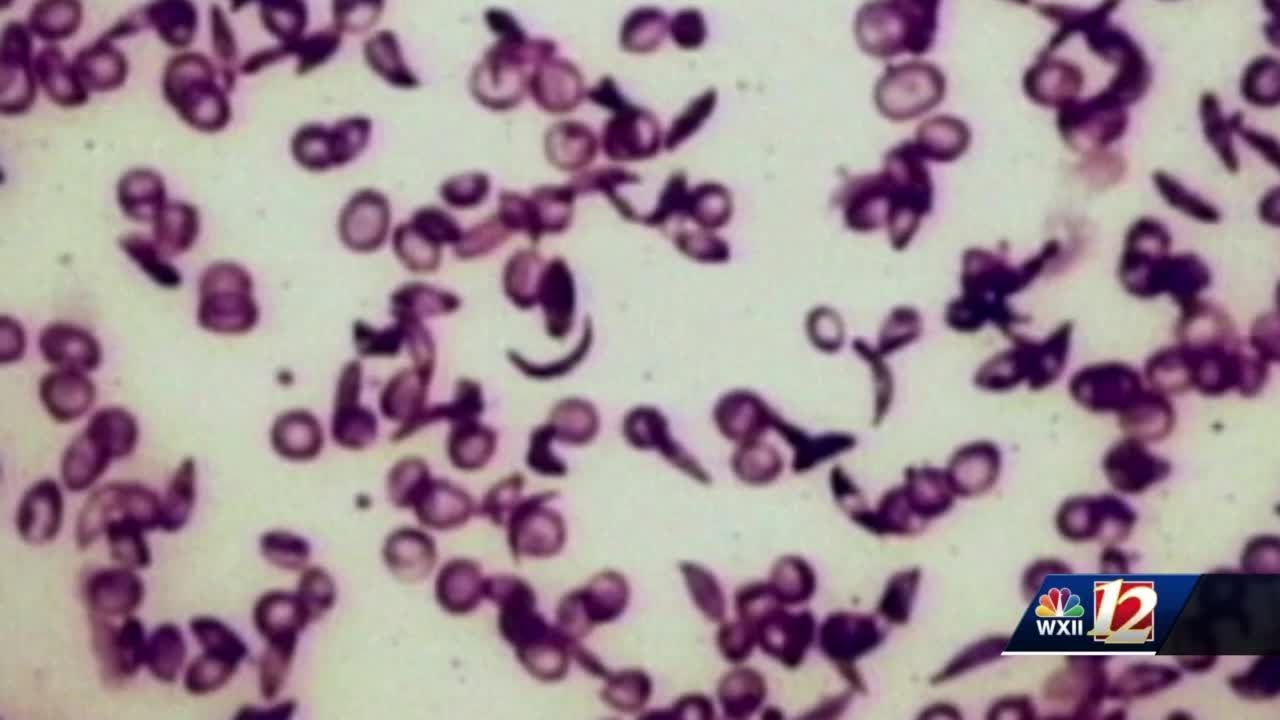 Saddle Up for Sickle Cell - YouTube