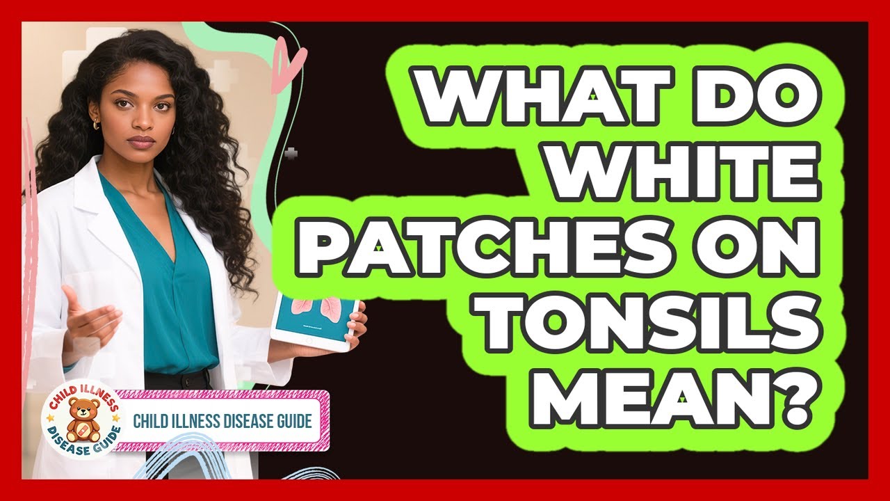 What Do White Patches On Tonsils Mean? - YouTube