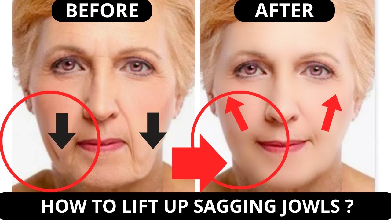 Face Lifting Exercises for Saggy Skin & Jowls | Easy & Effective! Relax ...