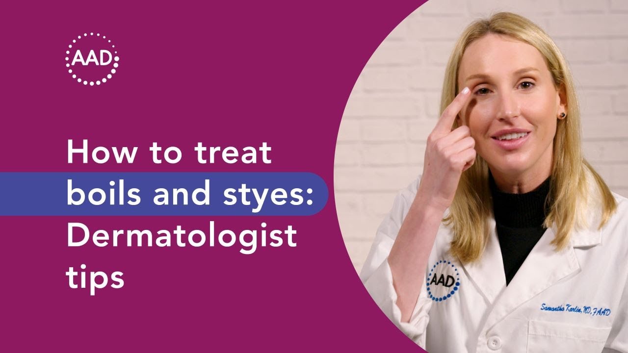 How to treat boils & styes: Dermatologist tips - YouTube