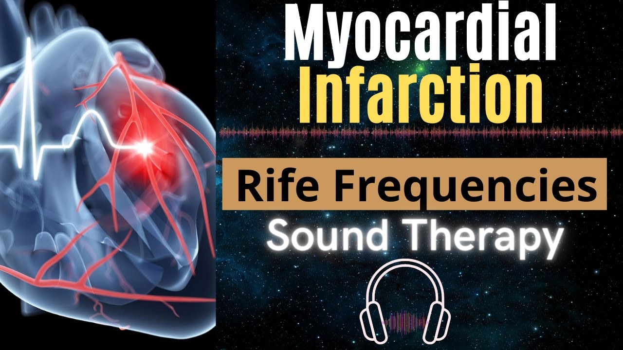 Rife Frequencies for Myocardial Infarction Treatment Sound Therapy for ...