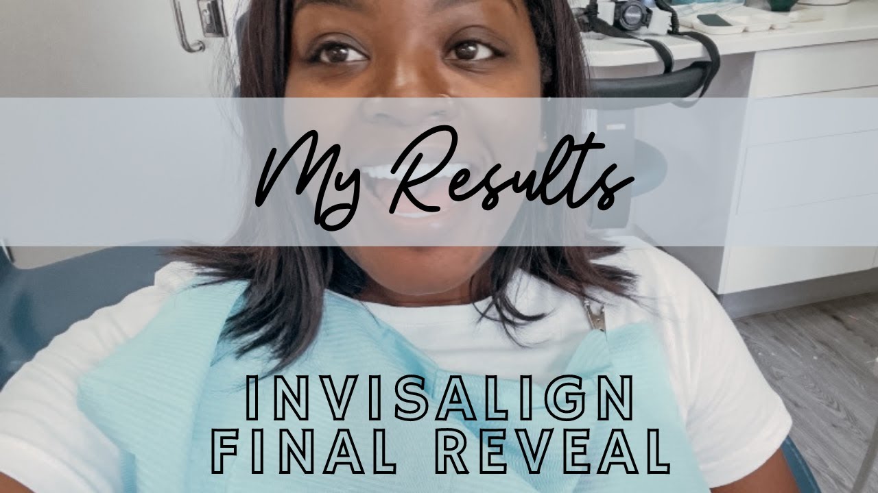 INVISALIGN FINAL REVEAL!! | Invisalign Vlog Series | Results - YouTube