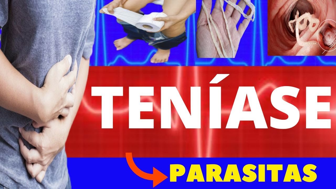 TENÍASE (SOLITÁRIA) - CARACTERÍSTICAS, CICLO, SINTOMAS, DIAGNÓSTICO E ...