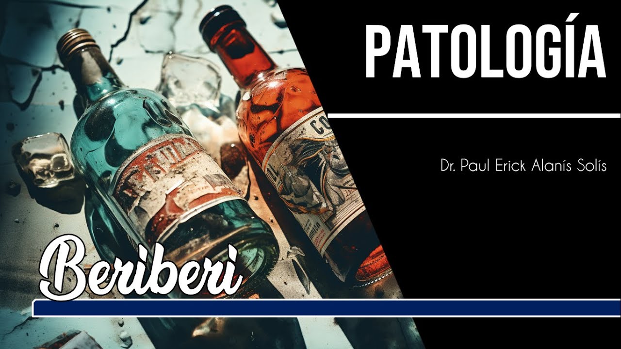 Deficiencia De Vitamina B Beriberi