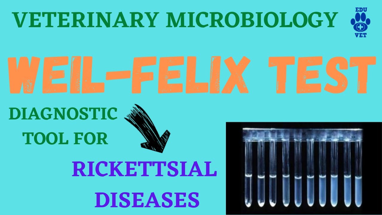 Weil-Felix Test ! Diagnosis for Rickettsiosis - YouTube