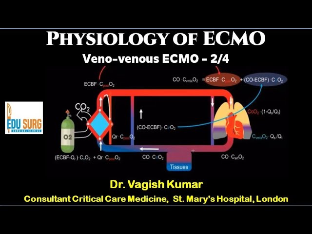 Ecmo Circuit Diagram