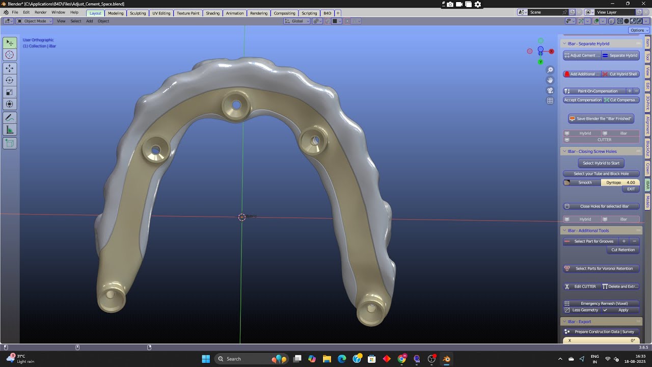 How to check scanbody scan for upper & lower arch & full mouth design ...