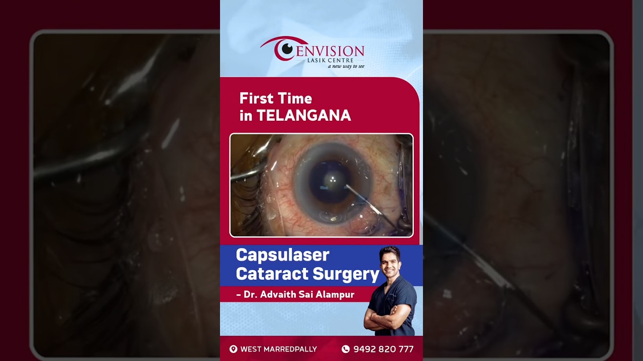 First time in Telangana - Capsulaser Cataract Surgery - Best eye ...