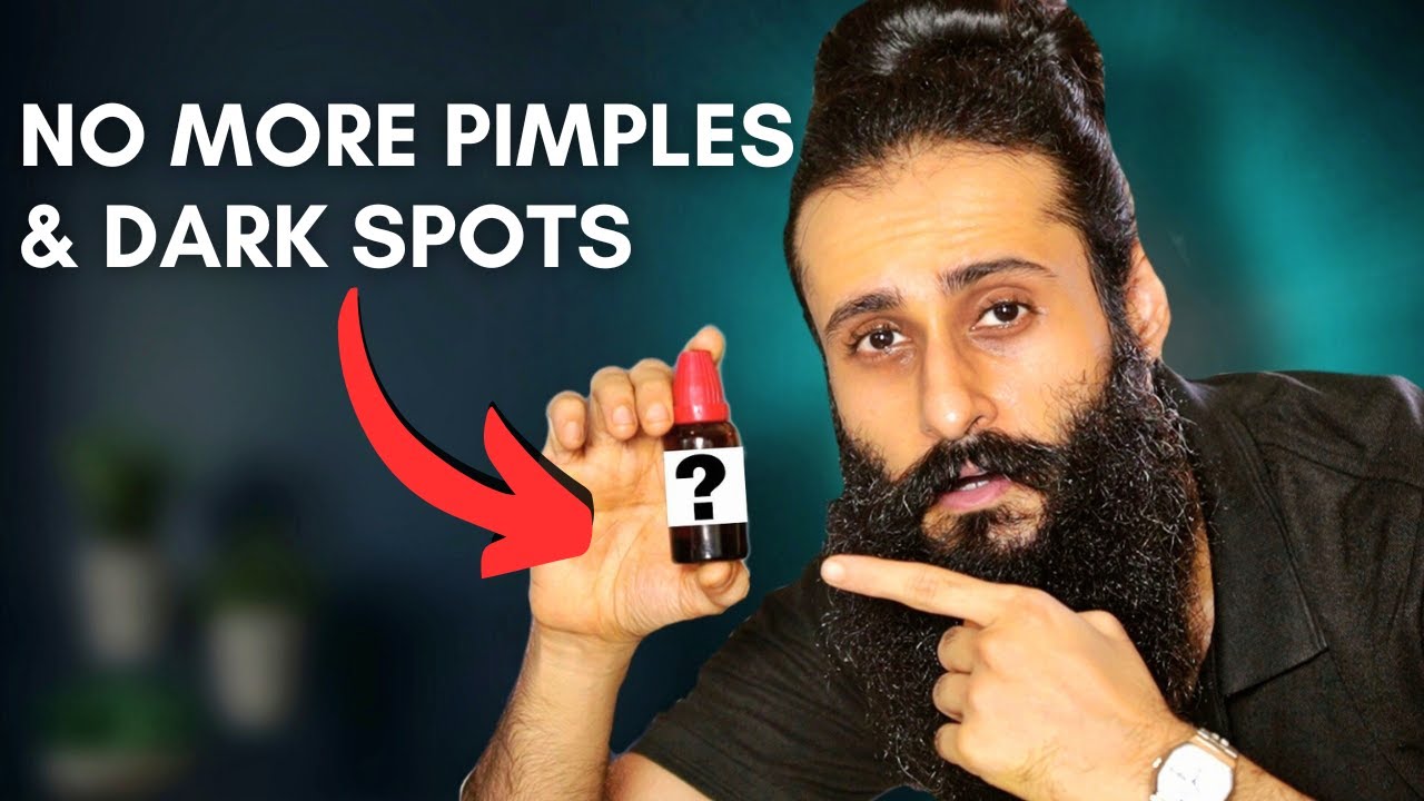 Simple Solution For Pimples, Dark spots, Pigmentation | Bearded Chokra ...
