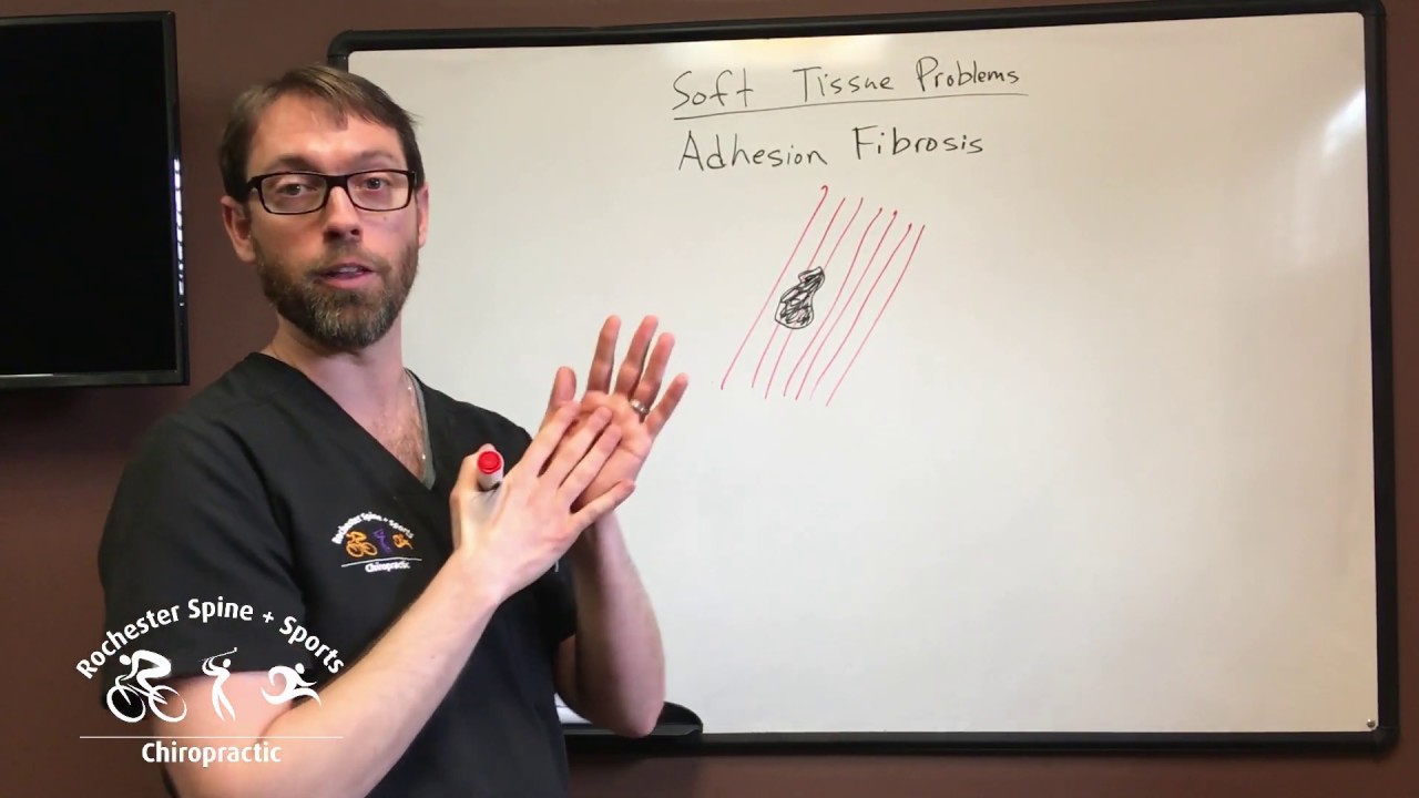 Soft Tissue Problems: Adhesion Fibrosis - YouTube