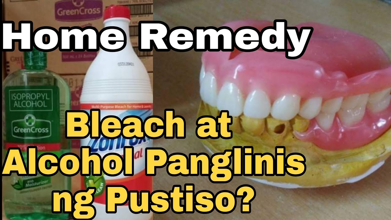 Panlinis ng Pustiso Home Remedy Bleach and Alcohol for cleaning your ...