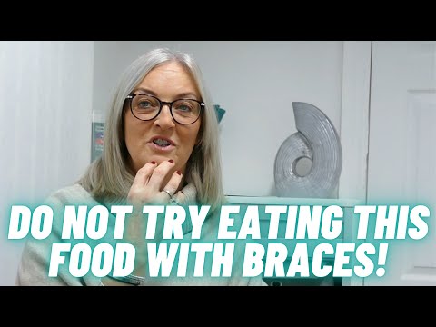 Do NOT try eating this food with braces on! | my six-month smile journey | ep 3