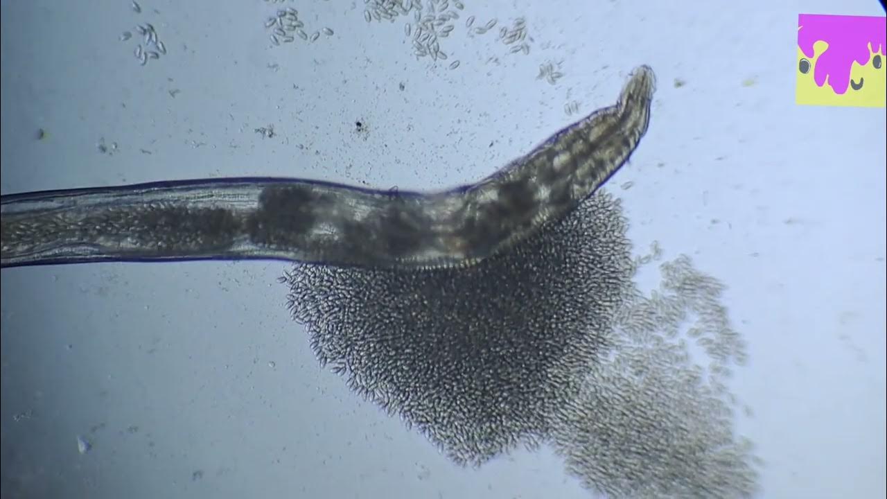 Enterobius vermicularis - YouTube