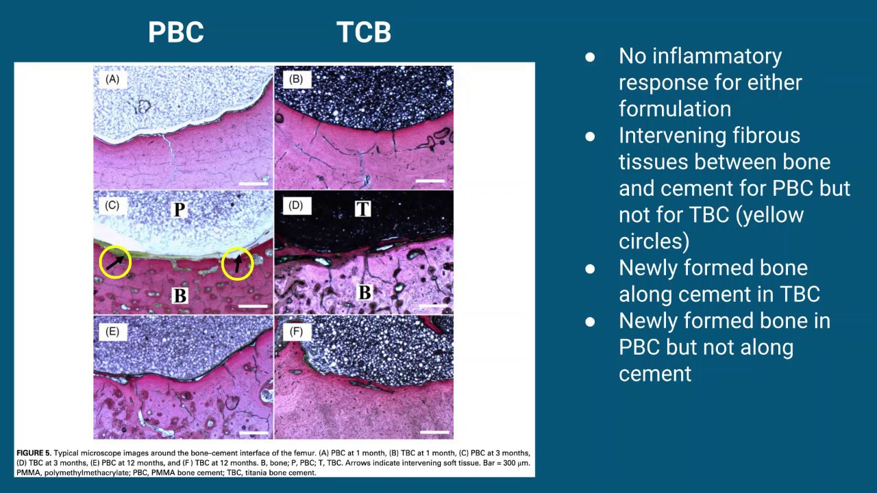BE 220 Final Project - Bioactive Bone Cement - YouTube