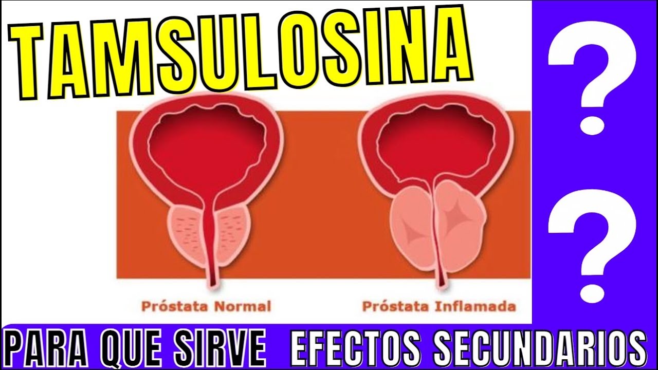 TAMSULOSINA | PARA QUE SIRVE, EFECTOS SECUNDARIOS, MECANISMO DE ACCION ...