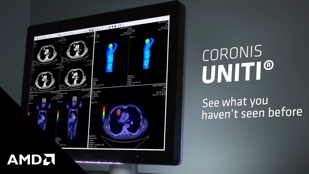 Barco Coronis Uniti® Medical Monitor — Deep Dive into the Technology ...