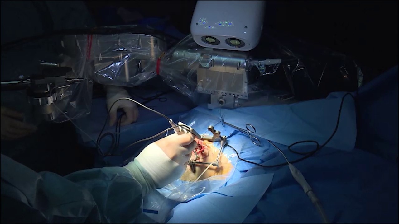 Robot-Assisted Cochlear Implantation - YouTube