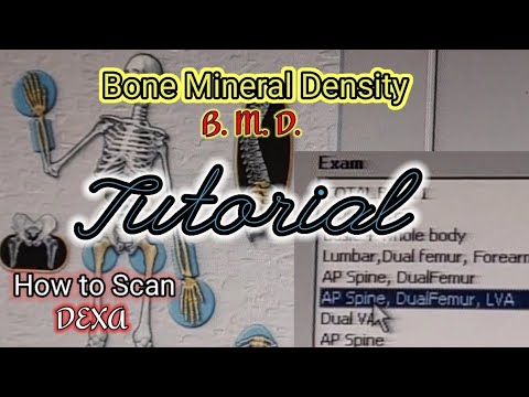 Tutorial 1, How to scan Dexa. AP Spine, Dual Femur, LVA. Frontliner ...