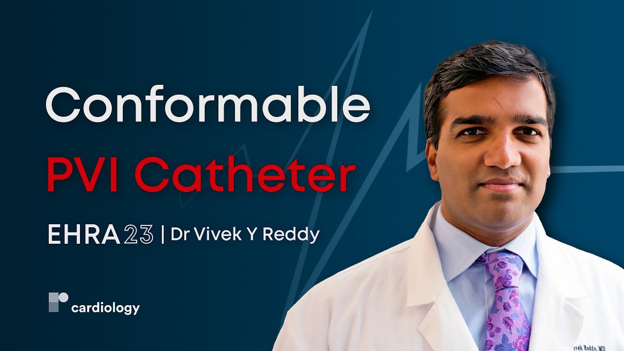EHRA 23: Conformable PVI Catheter for Pulmonary Vein Isolation - YouTube
