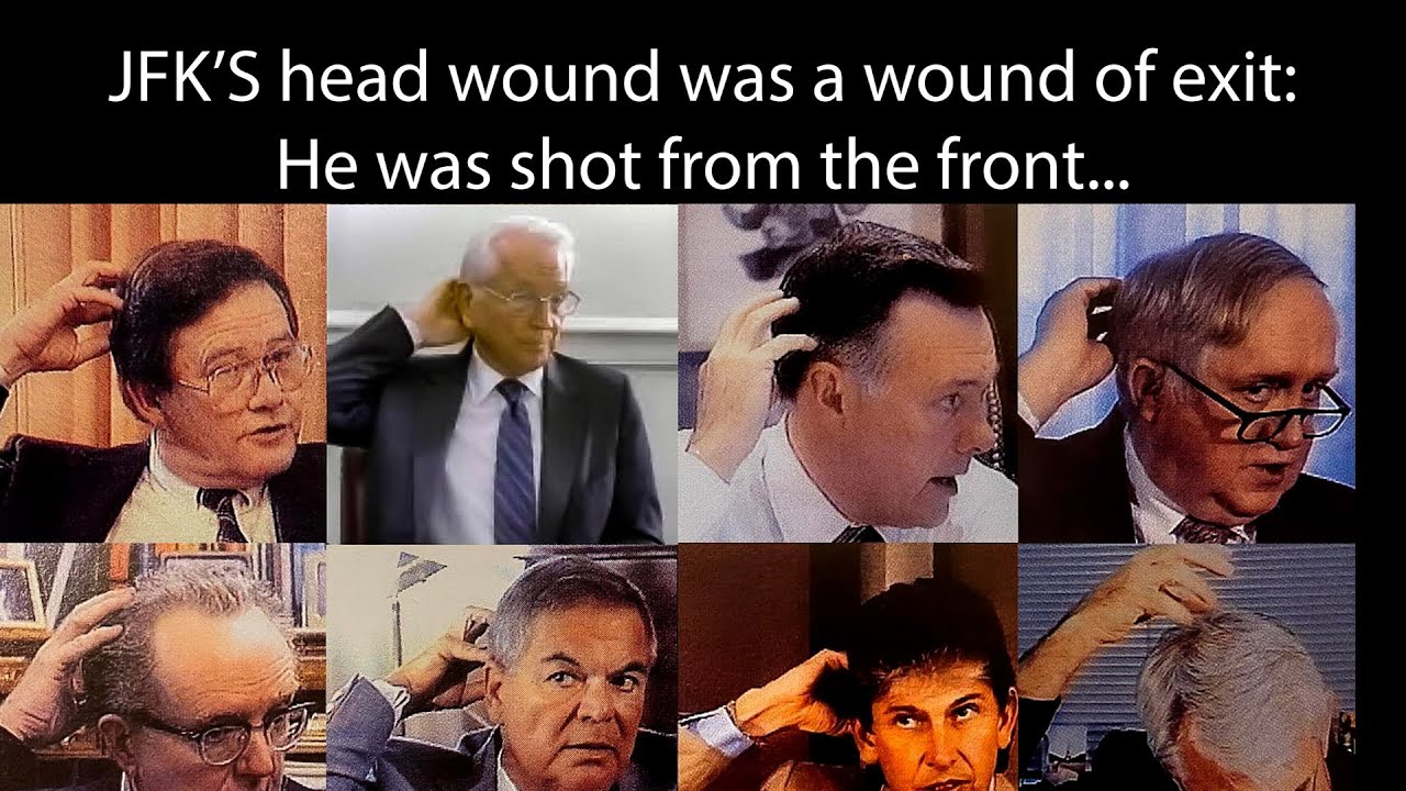 JFK's head wound was a wound of exit...He was shot from the front ...