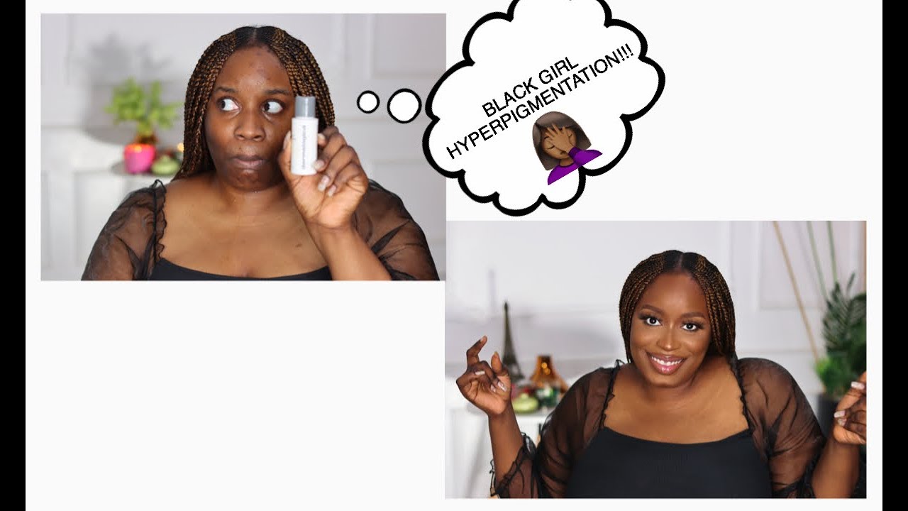 BLACK GIRL WITH HYPERPIGMENTATION MAKEUP TRANSFORMATION (PLUS LIFE ...
