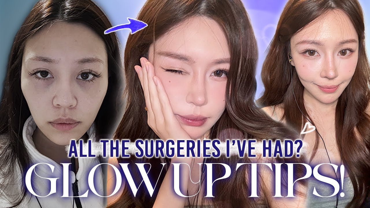 I GOT THE BEST GLOW-UP IN MY LIFE! | Kylie's plastic surgery journey at ...