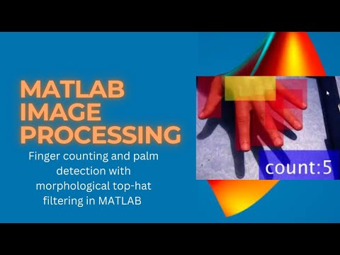 MATLAB imtophat finger counting image processing Project with code ...