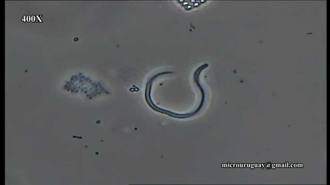 Muy rara spirochaeta - very rare Spirochaeta - YouTube