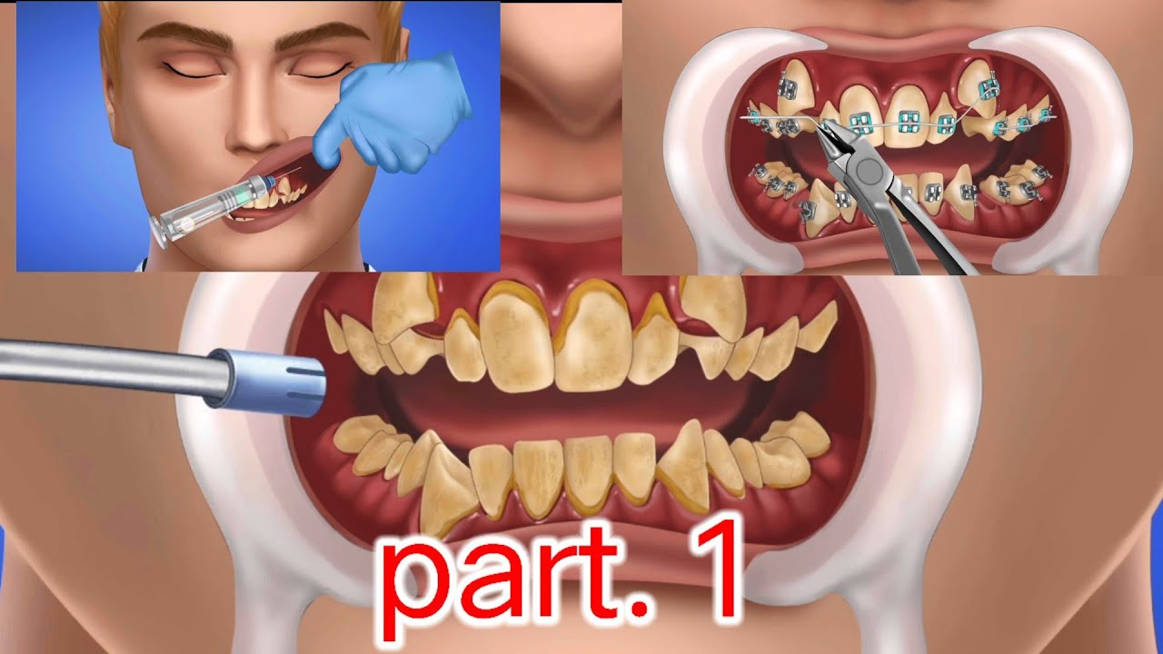 dkasmr tith treatment in hospital|dkasmr tooth clipping| - YouTube
