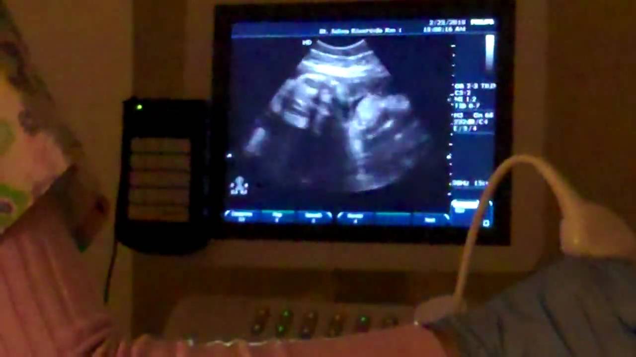 33 Weeks Pregnant Ultrasound - YouTube