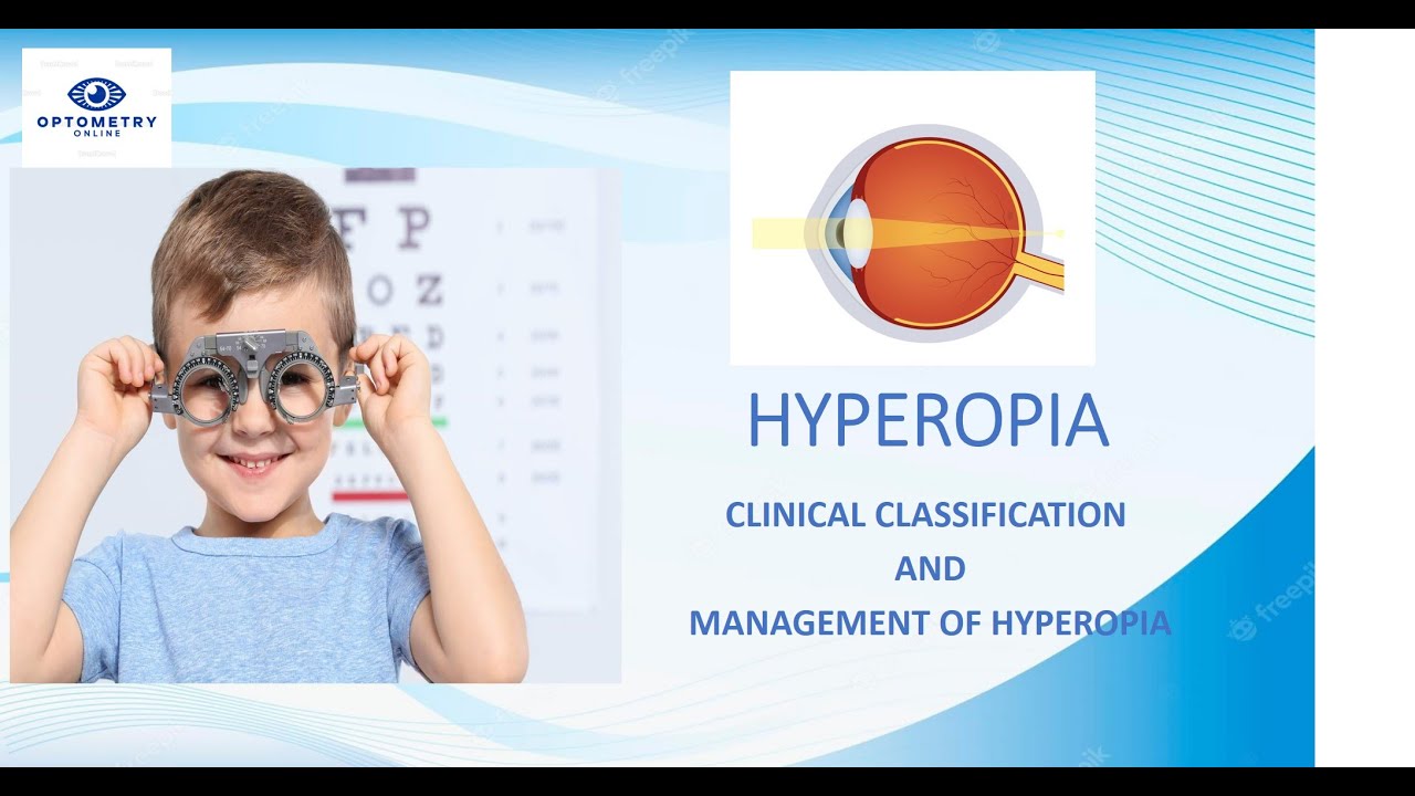 HYPEROPIA, CLASSIFICATION AND MANAGEMENT OF HYPEROPIA - YouTube