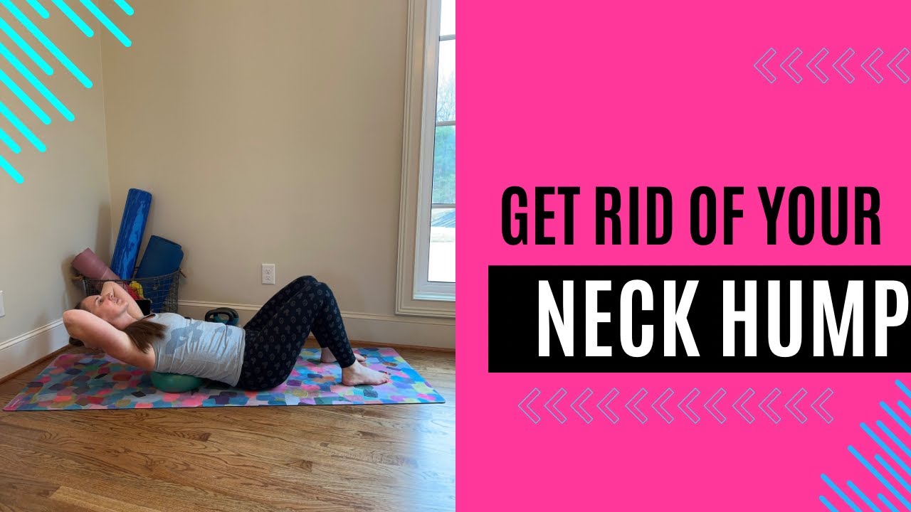 Get Rid of your Neck Hump & Improve your Posture - YouTube