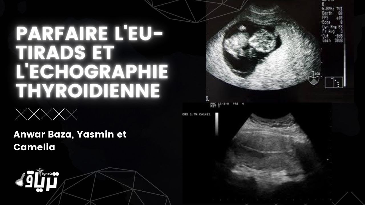 #Radiologie - EU-TIRADS ET L'ECHOGRAPHIE THYROIDIENNE EN POCHE!!! GRACE ...